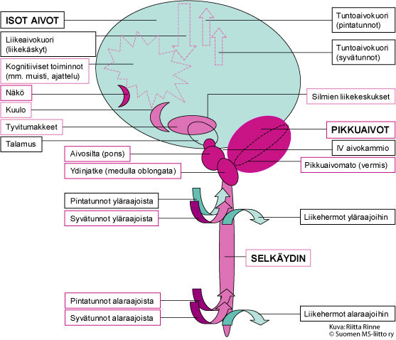 Spinoserebellaarinen ataksia tyyppi 7 (SCA7) - Neuroliitto Neuroliitto